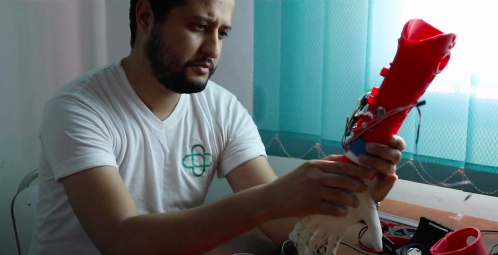 En Tunisie, Cure Bionics fabrique des mains bioniques et modulables ...